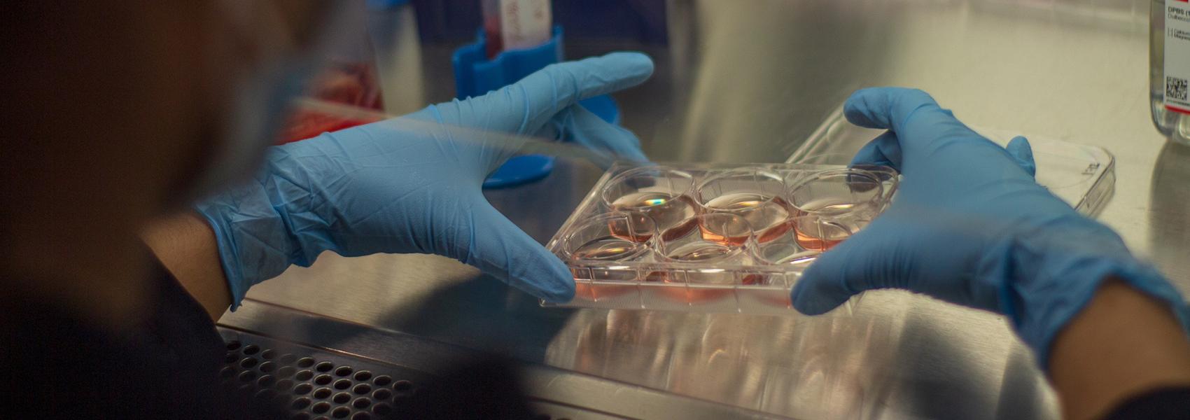 Sickle Cell Patient and Caregiver Resources | Boston Medical Center